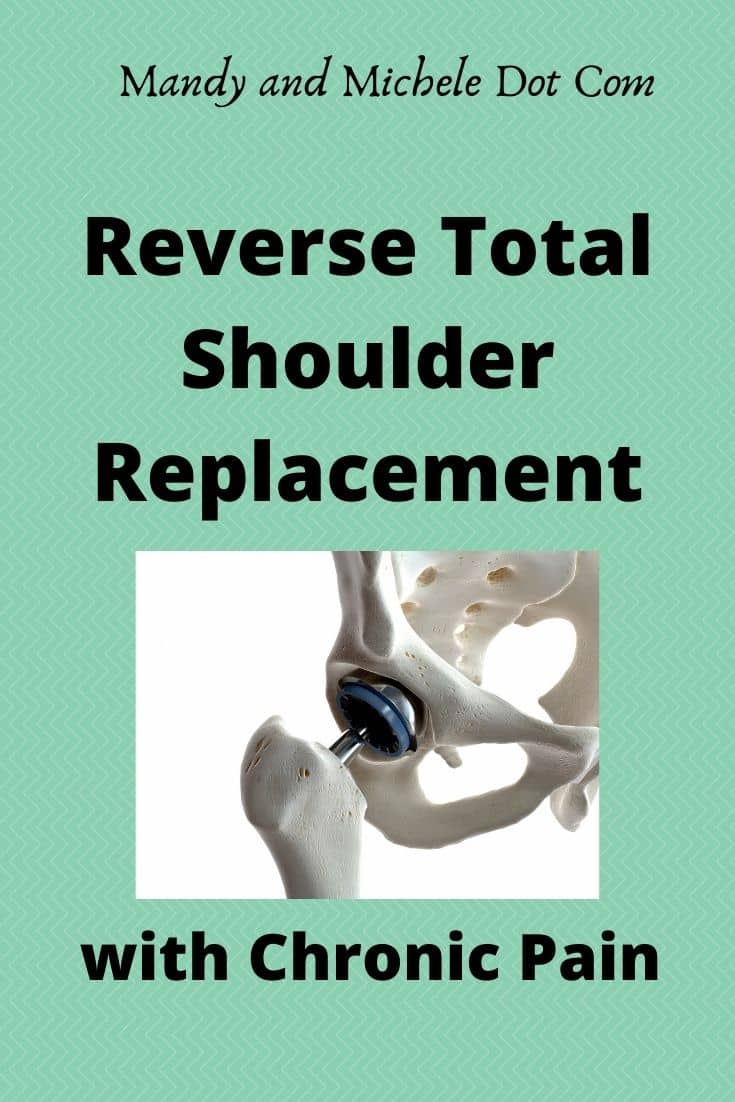 My Experience with Rheumatoid Arthritis and a Reverse Total Shoulder ...